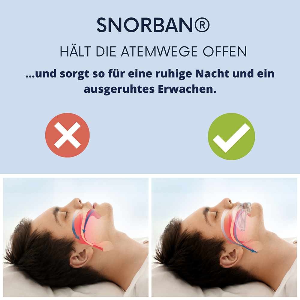 SnorBan Schnarchschiene nur 61,95 € - BPA-frei kaufen